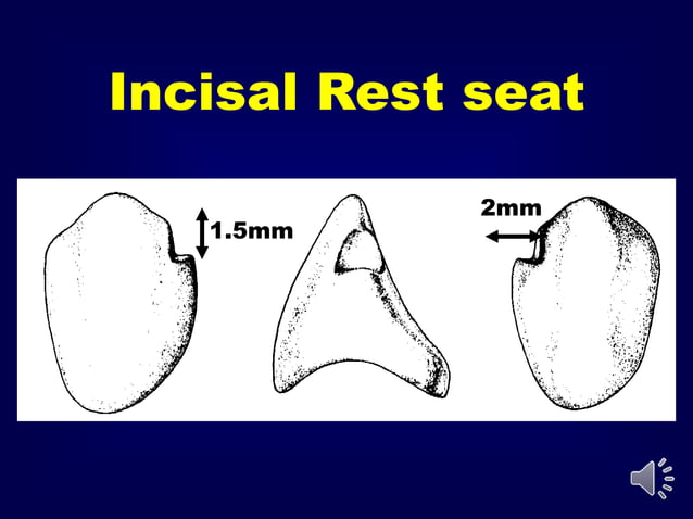 b- Types of tooth rests | PPT | Dental Health | Diseases and Conditions
