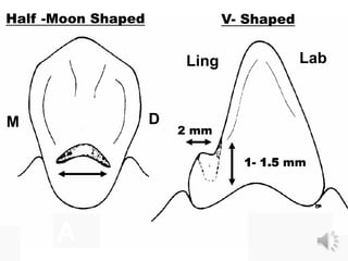b- Types of tooth rests | PPT