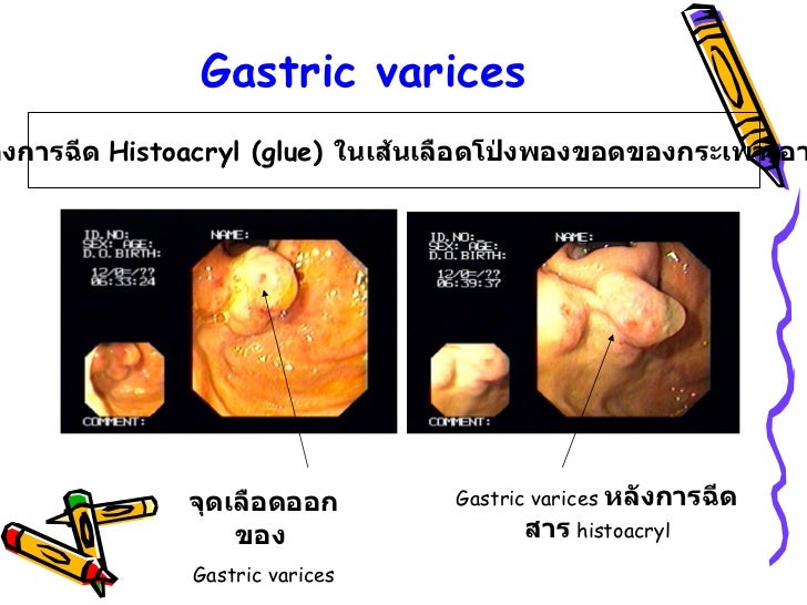 TAEM10:Roles of endoscopic nurse
