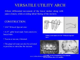 06 versatile utility arch