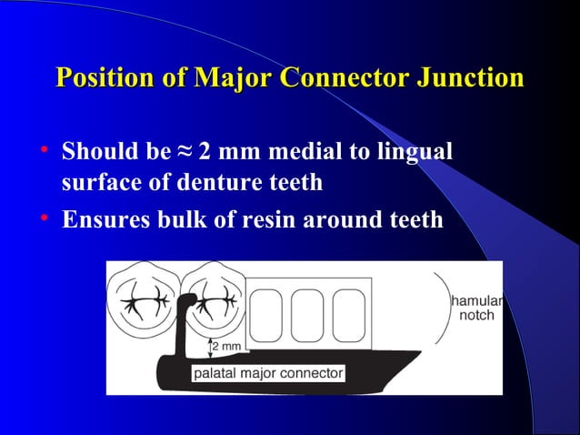 07 1. minor connectors | PPT | Dental Health | Diseases and Conditions