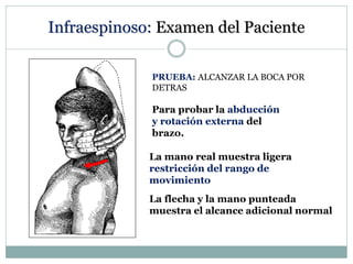 07. smf infraespinoso prv | PPT