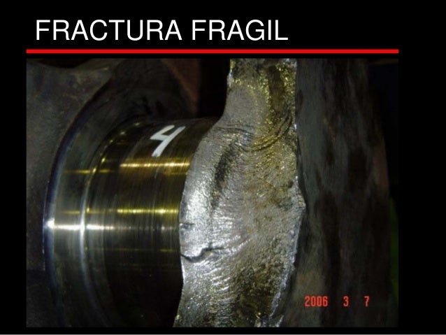07. fracturas