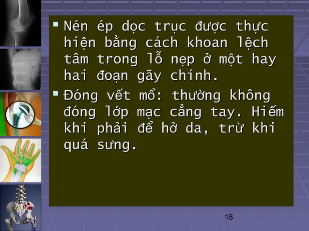 07. forearm shaft fractures v nese | PPT