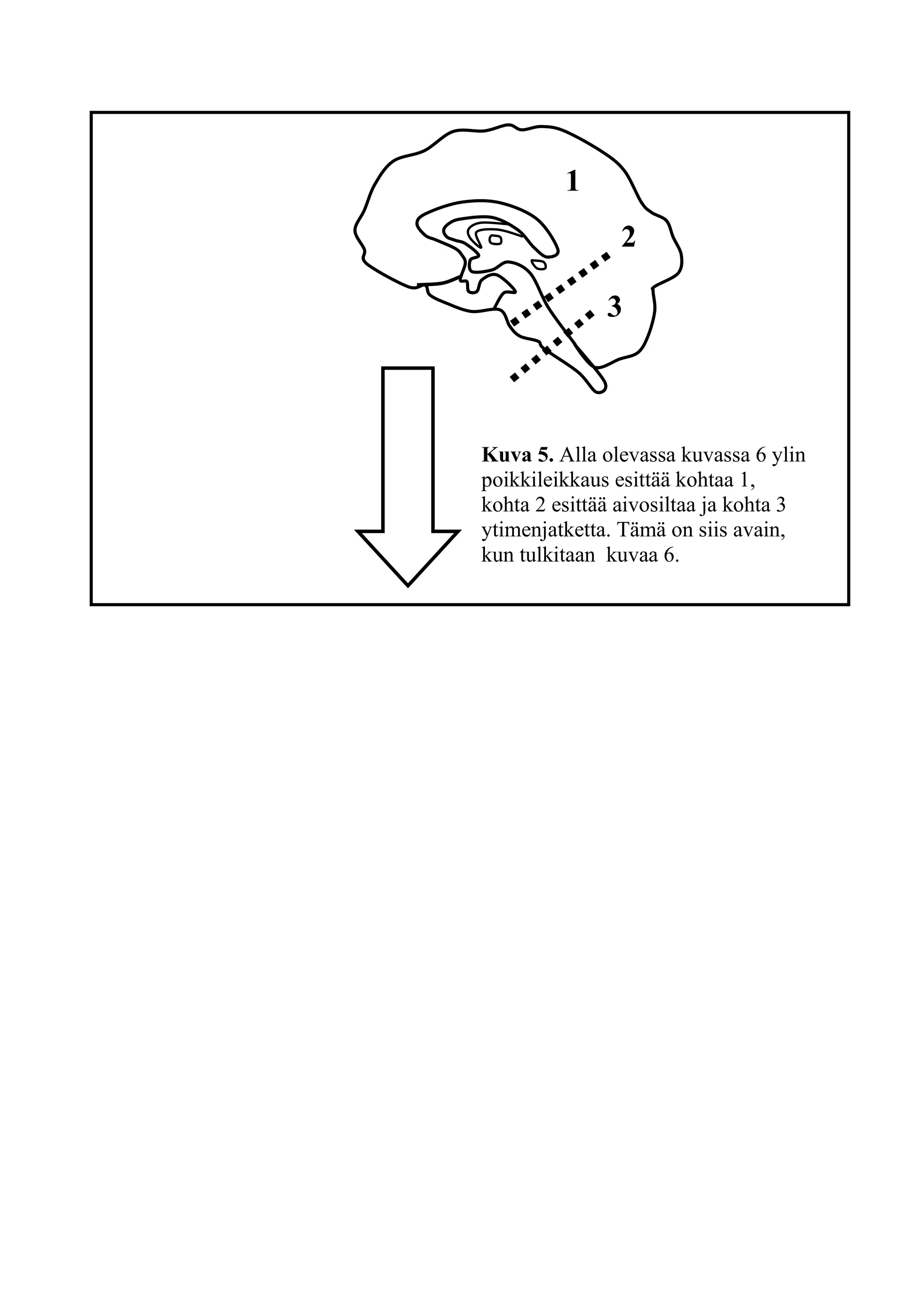 Kuuloaistin neurologiaa | PDF