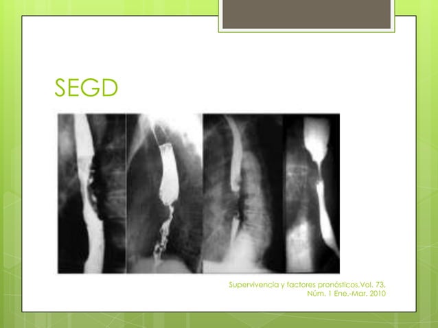 Carcinoma de Esofago y Cardias | PPT