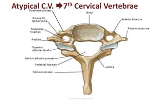 Atypical Cervical Vertebra
