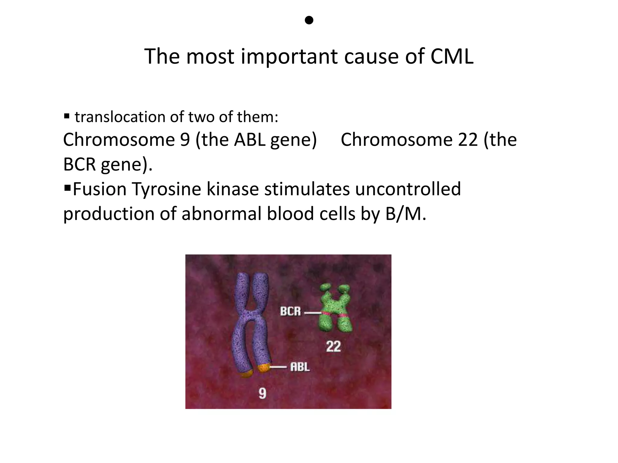 Chronic myeloid Leukemia | PPTX