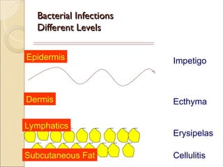 Common Skin Infections in primary care.ppt