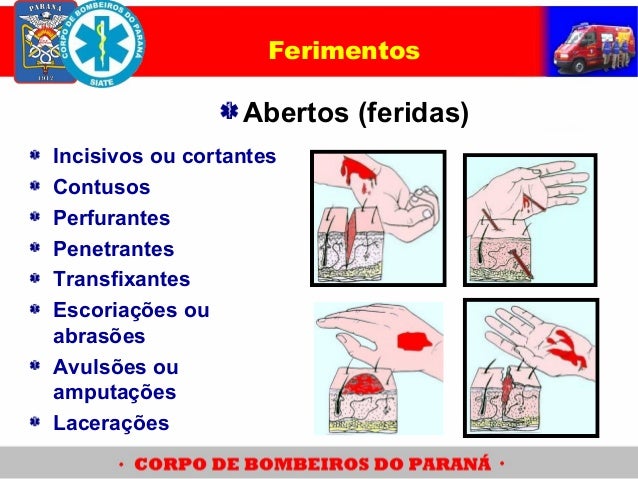 07 ferimentos