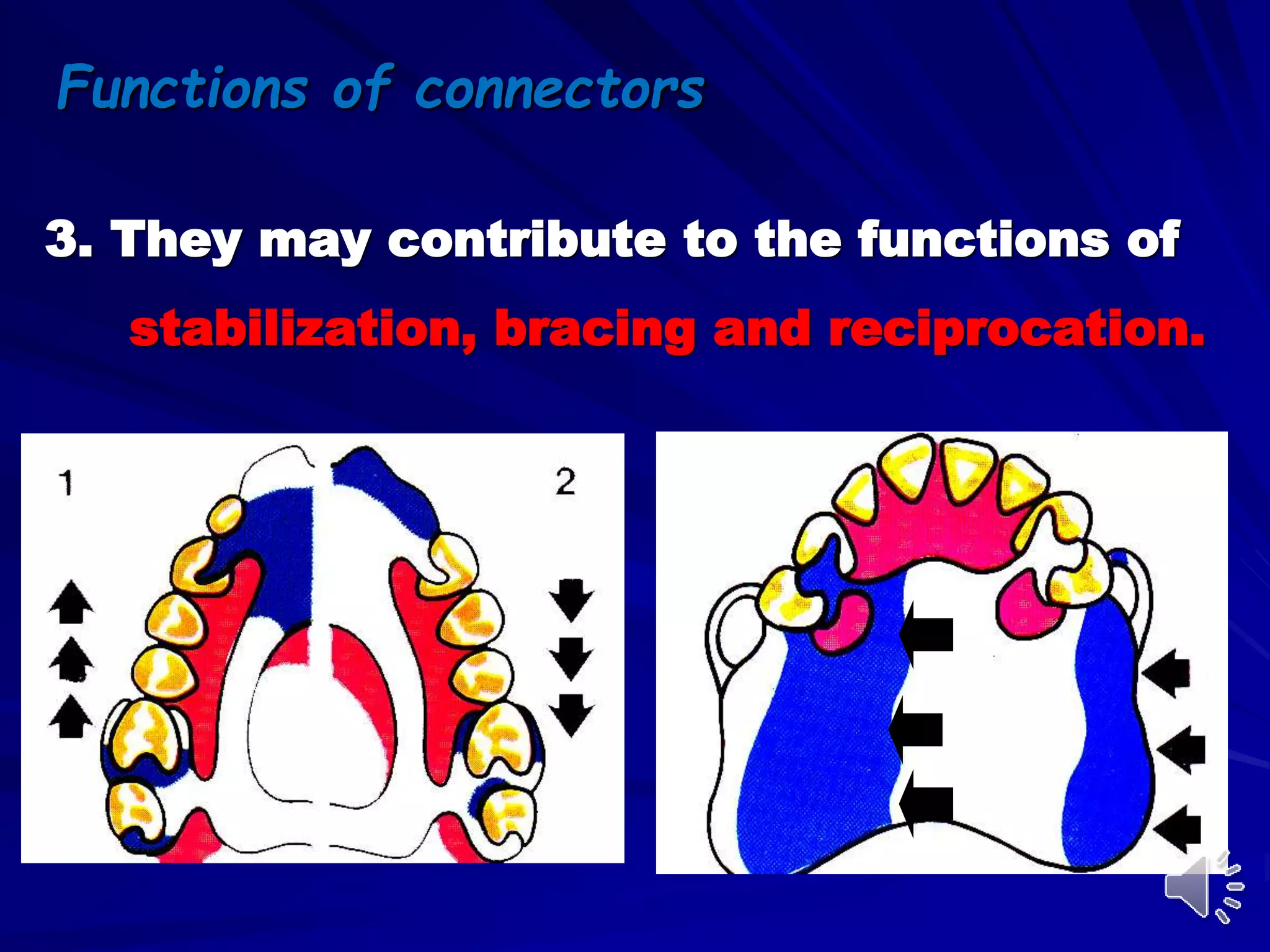 Maxillary major connectors | PPT