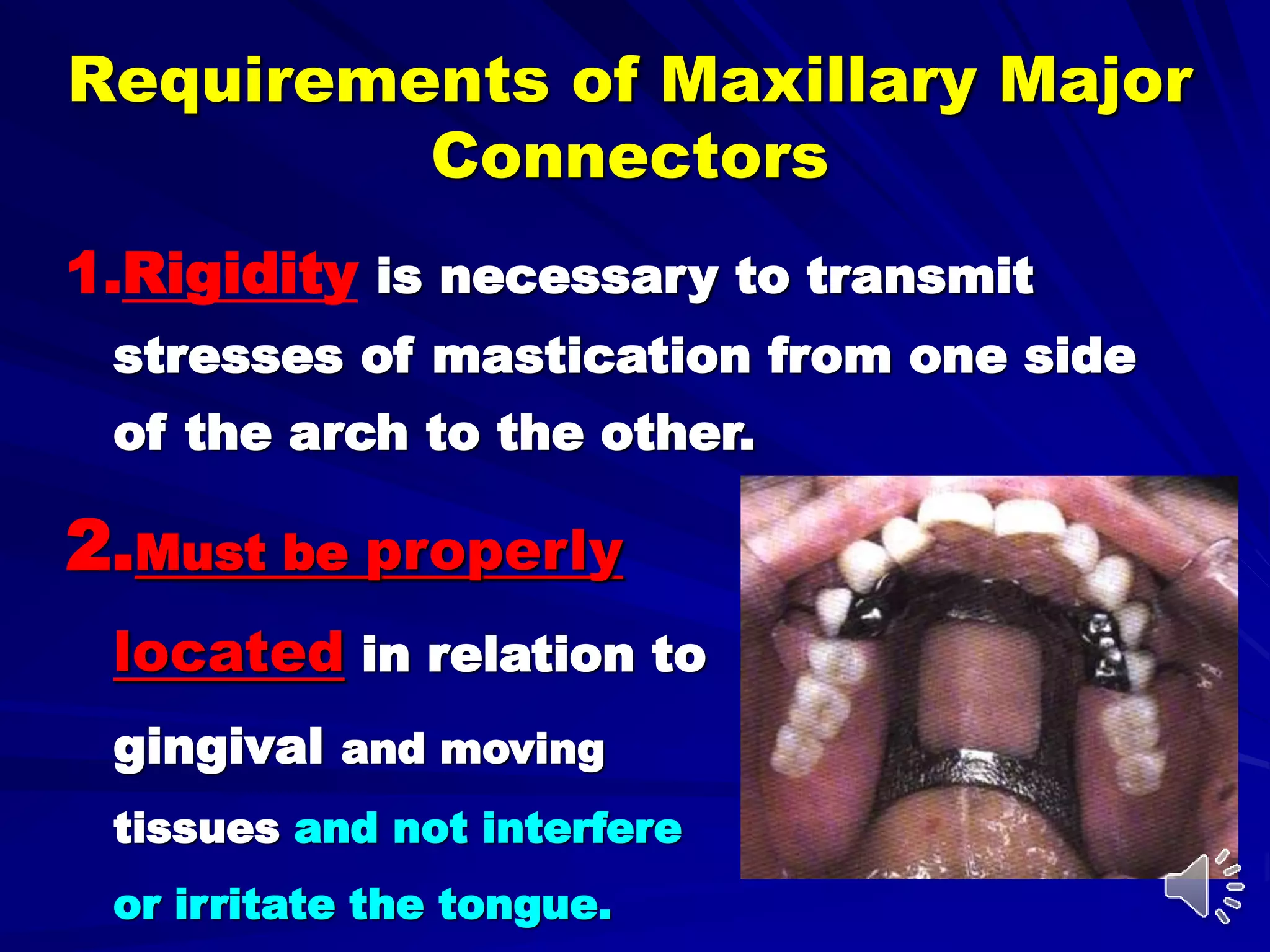 Maxillary major connectors | PPT