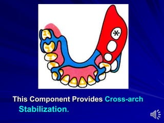 Maxillary major connectors | PPT