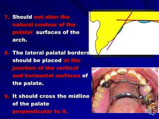Maxillary major connectors | PPT