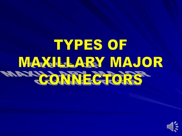 Maxillary major connectors | PPT