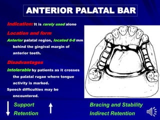 Maxillary major connectors | PPT