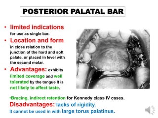 Maxillary major connectors | PPT