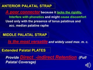 Maxillary major connectors | PPT