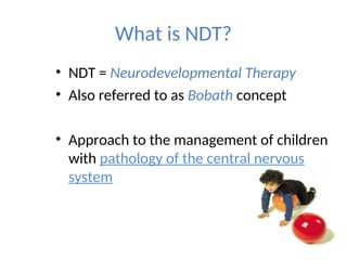 07- Neurodevelopmental therapy (NDT).ppt