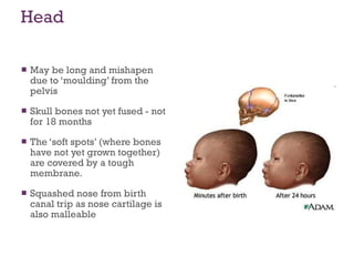 07 the neonate | PPT
