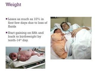 07 the neonate | PPT
