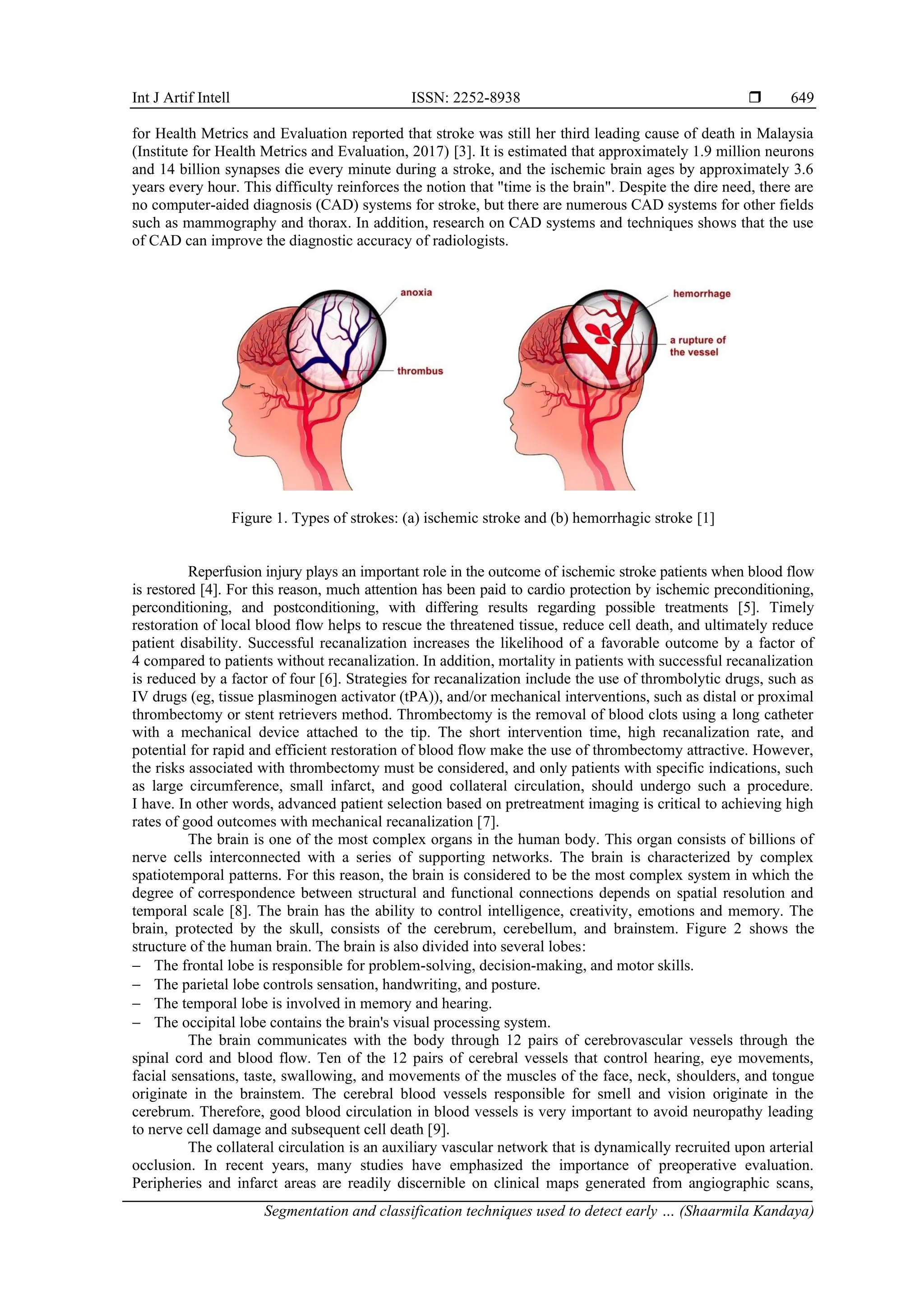 Segmentation and classification techniques used to detect early stroke diagnosis using brain ...
