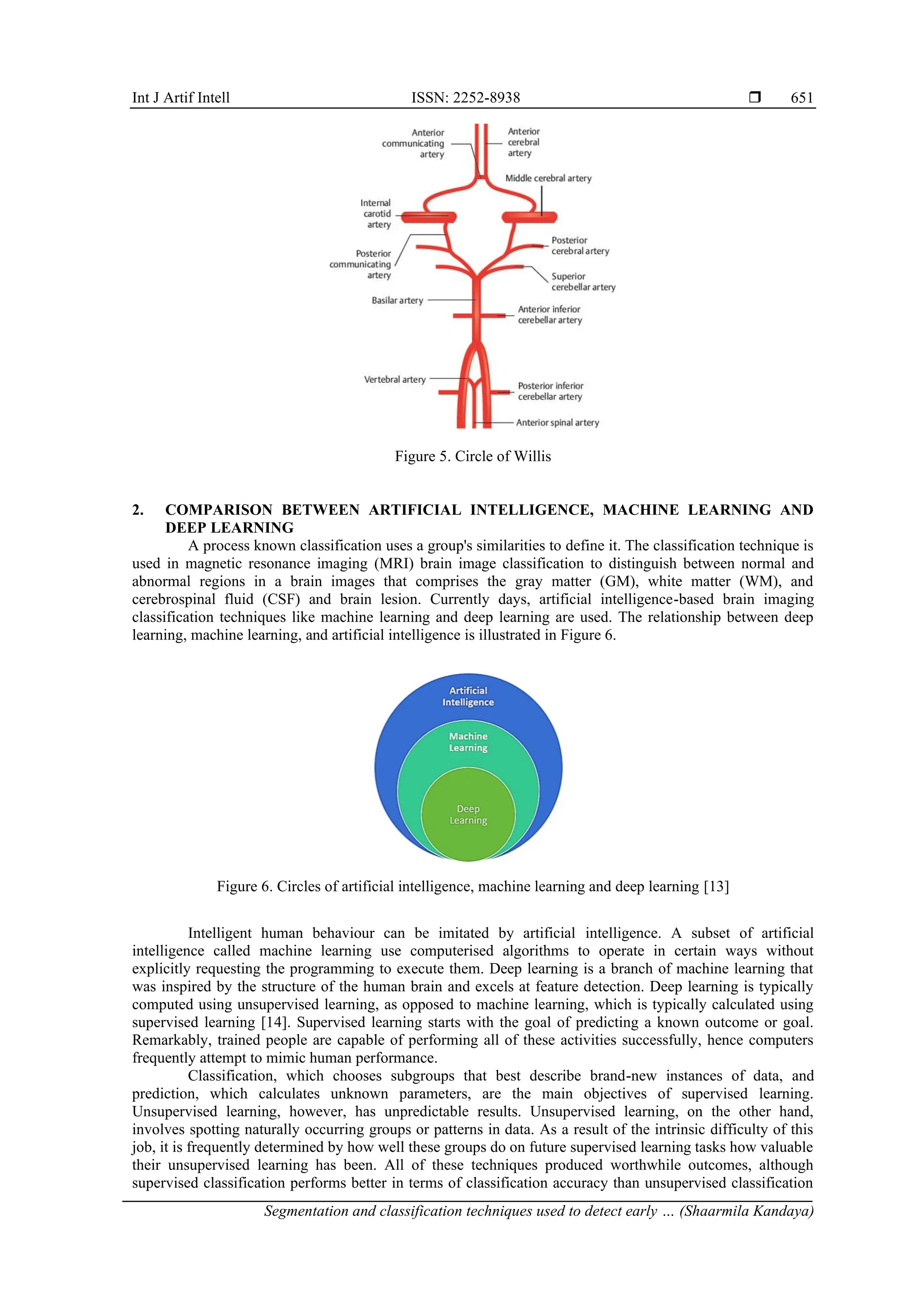Segmentation and classification techniques used to detect early stroke diagnosis using brain ...
