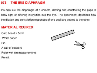 073 the iris diaphragm | PPT