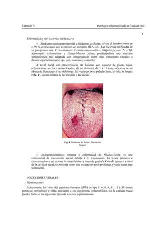 074 - PATOLOGÍA INFLAMATORIA DE LA CAVIDAD ORAL.pdf