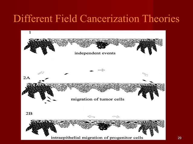 Epidemiology of oral cancer | PPT