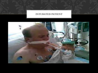 Extubation presentation | PPTX