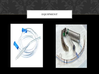 Extubation presentation | PPTX