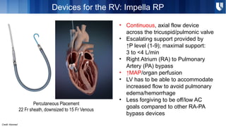 Devices in the Management of Acute Heart Failure (or) Cardiogenic Shock ...