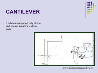 biomechanics of removable partial denture | PPT
