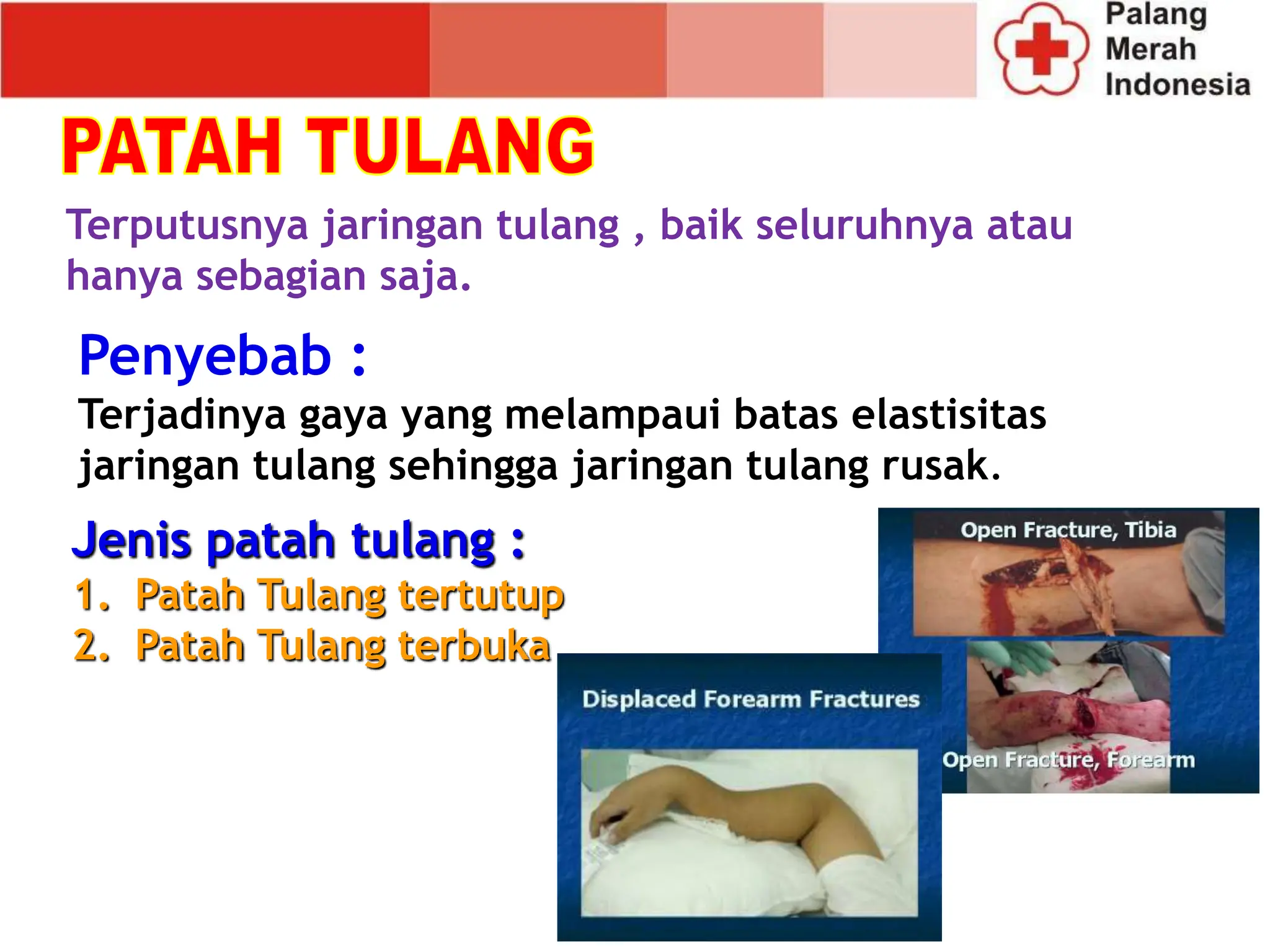 Cedera Sistem Otot Rangka.ppt terbagi .. | PPT