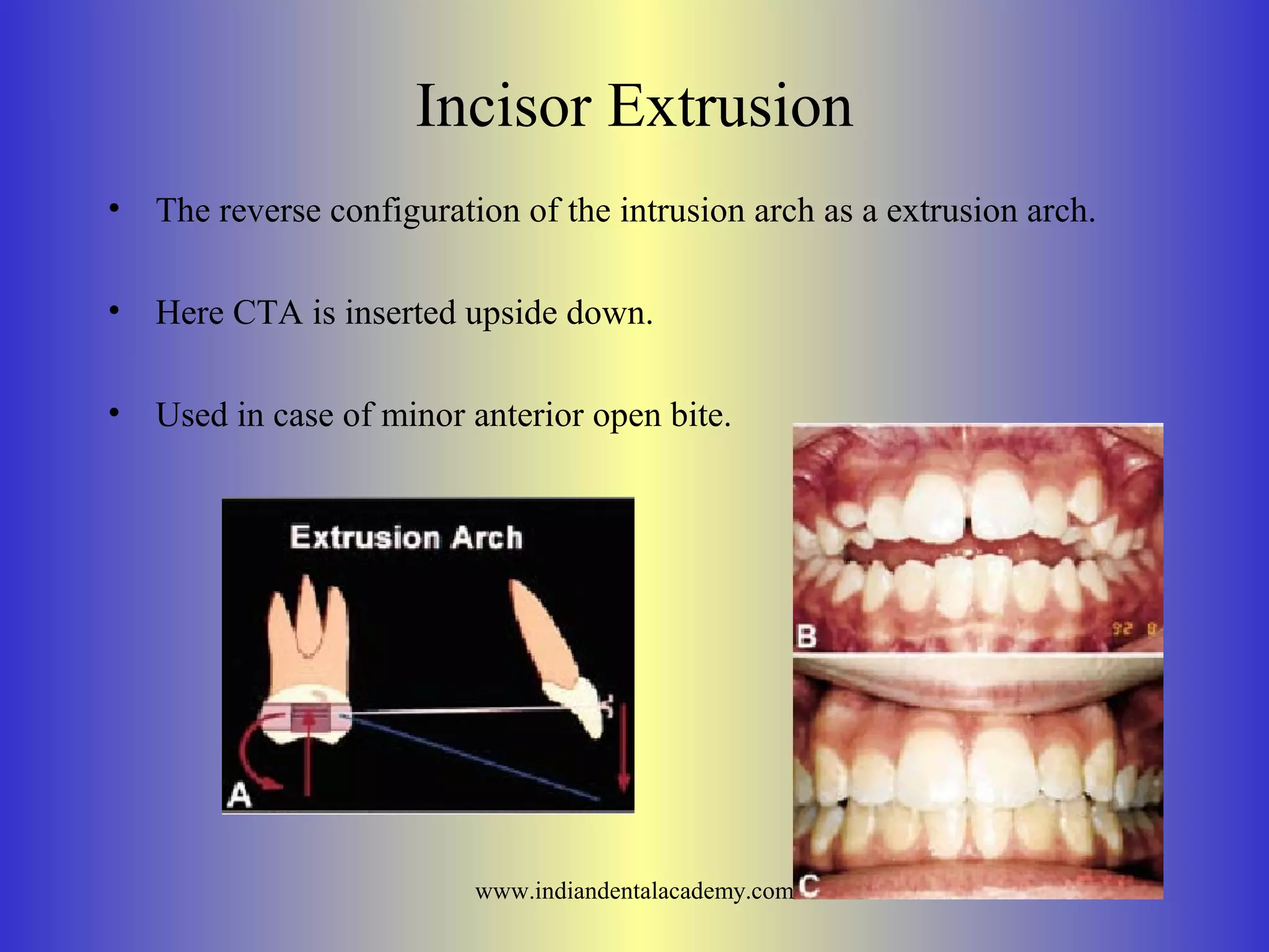 07 connecticut intrusion arch | PPT