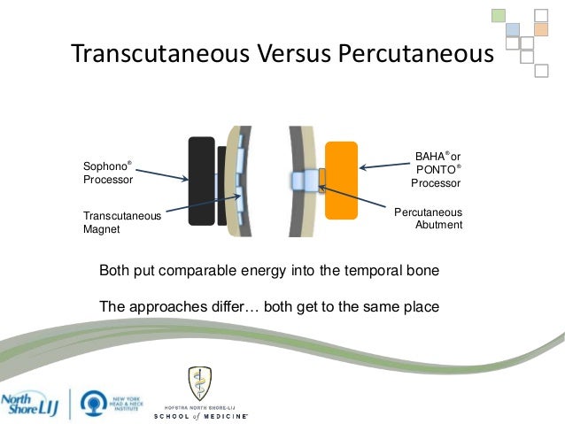 Implantable Course 2015 Sophono
