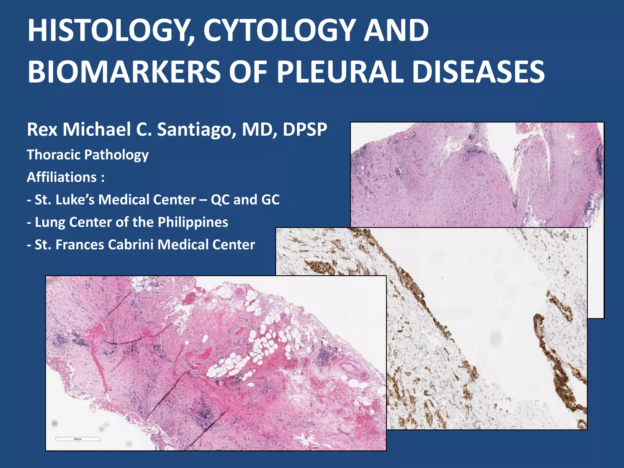 07 histology, cytology and biomarkers in pleural diseases | PDF