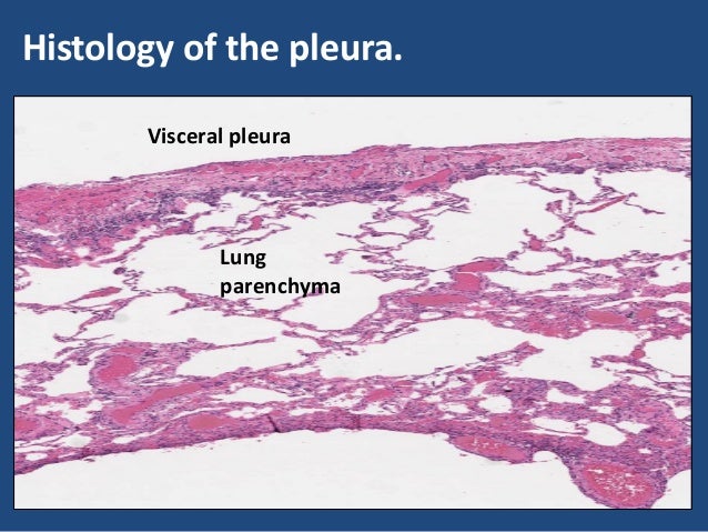 07 histology, cytology and biomarkers in pleural diseases