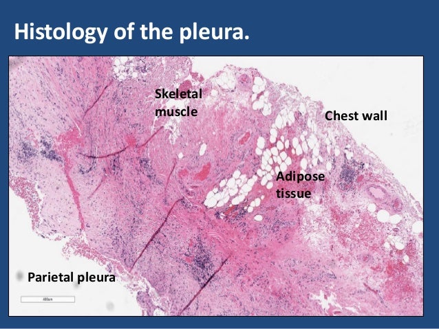 07 histology, cytology and biomarkers in pleural diseases