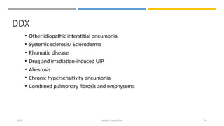 07 Idiopathic Pulmonary Fibrosis Saifur Rahman.pptx