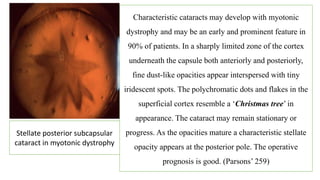Neuro-ophthalmology | PPT