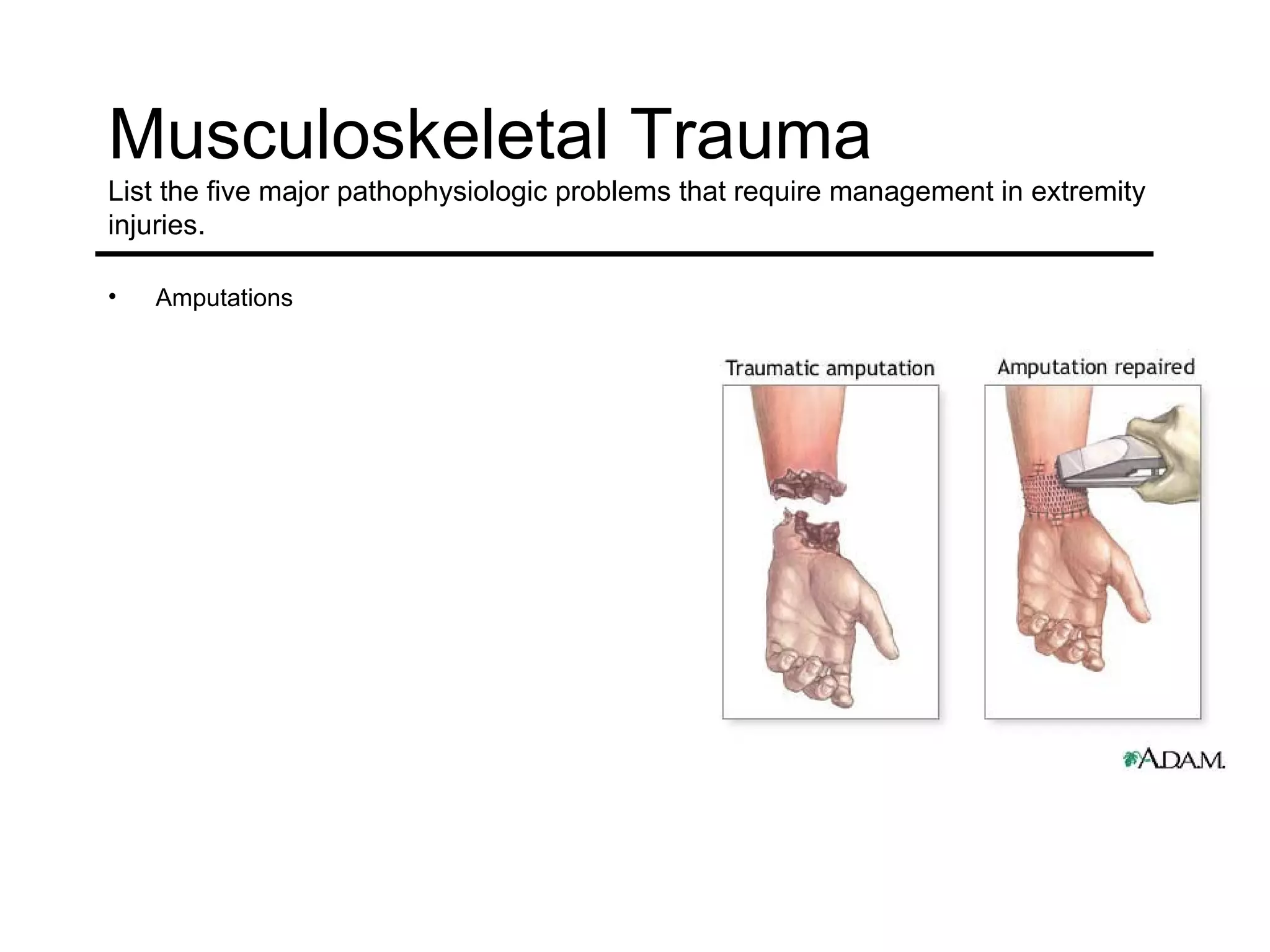 07 musculoskeletal trauma | PPT