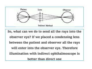 07 ophthalmoscope direct and indirect | PPTX