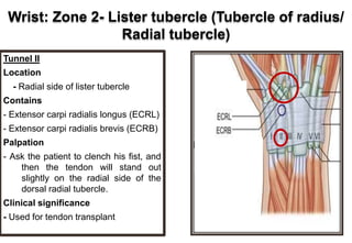 Listers Tubercle Palpation