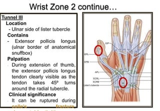 Listers Tubercle Palpation