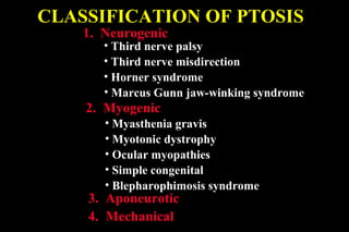 ptosis | PPT
