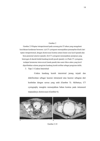 Trauma Buli-Buli (Vesika Urinaria) | DOC