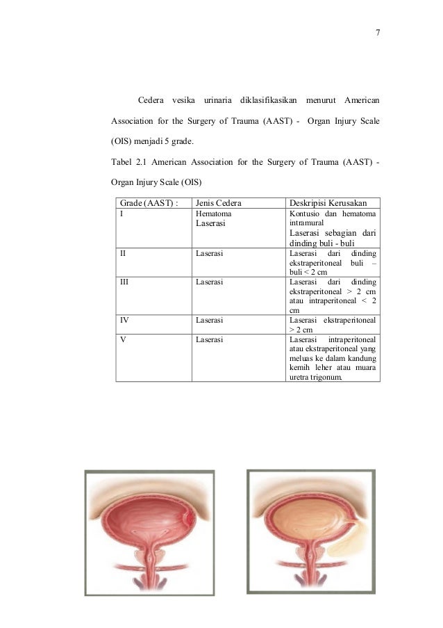 Trauma Buli-Buli (Vesika Urinaria)