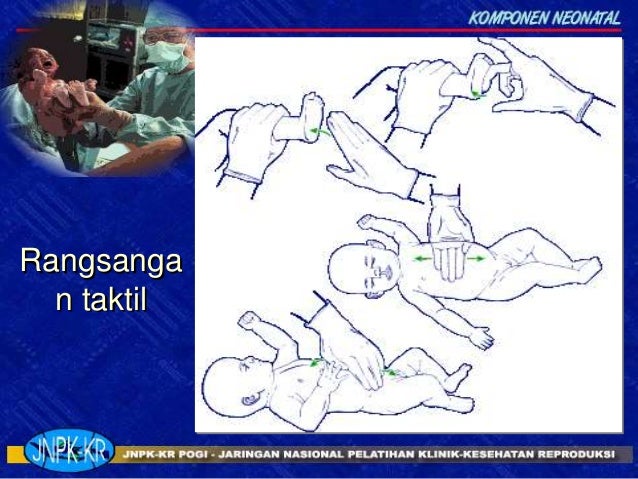 Resusitasi pada Bayi